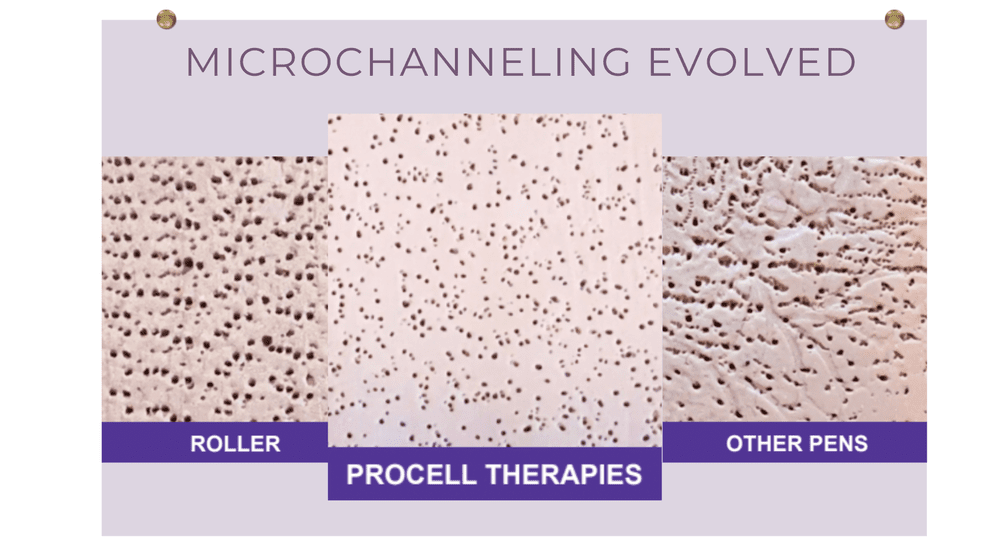 Look Years Younger Instantly - Discover the Benefits of Procell ...