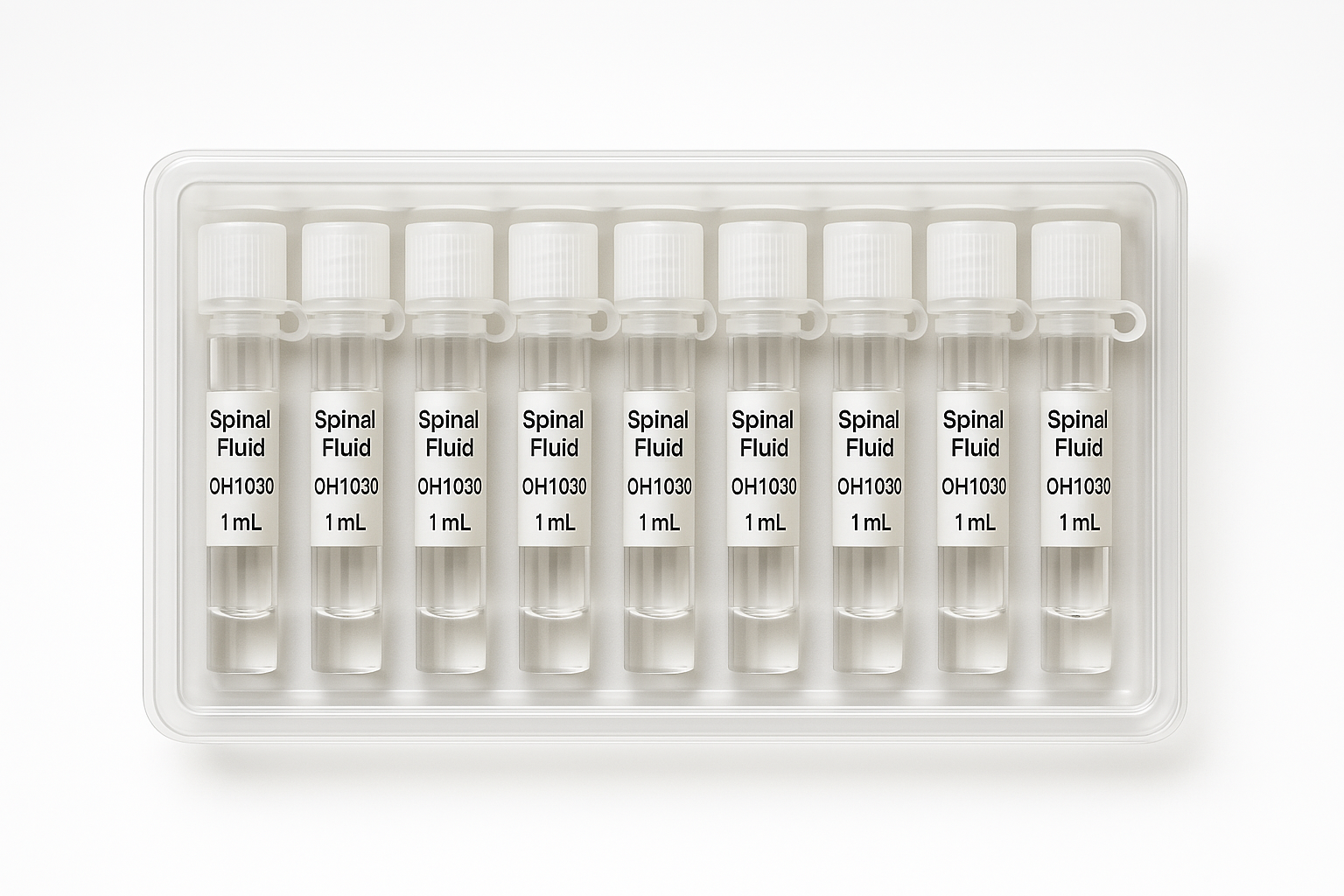 Human Spinal Fluid – High-Quality Matrix for Neurological Research and ...
