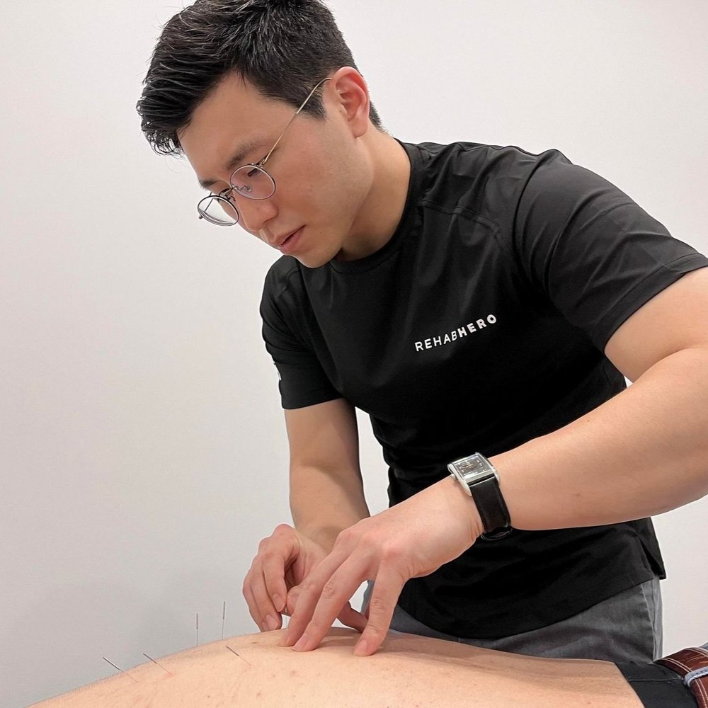 Toronto Acupuncturist near me — Rehab Hero