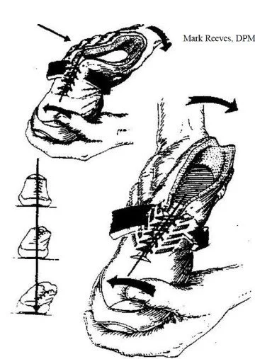 Running Shoe Motion Control Tests and Lacing Patterns — Rehab Hero