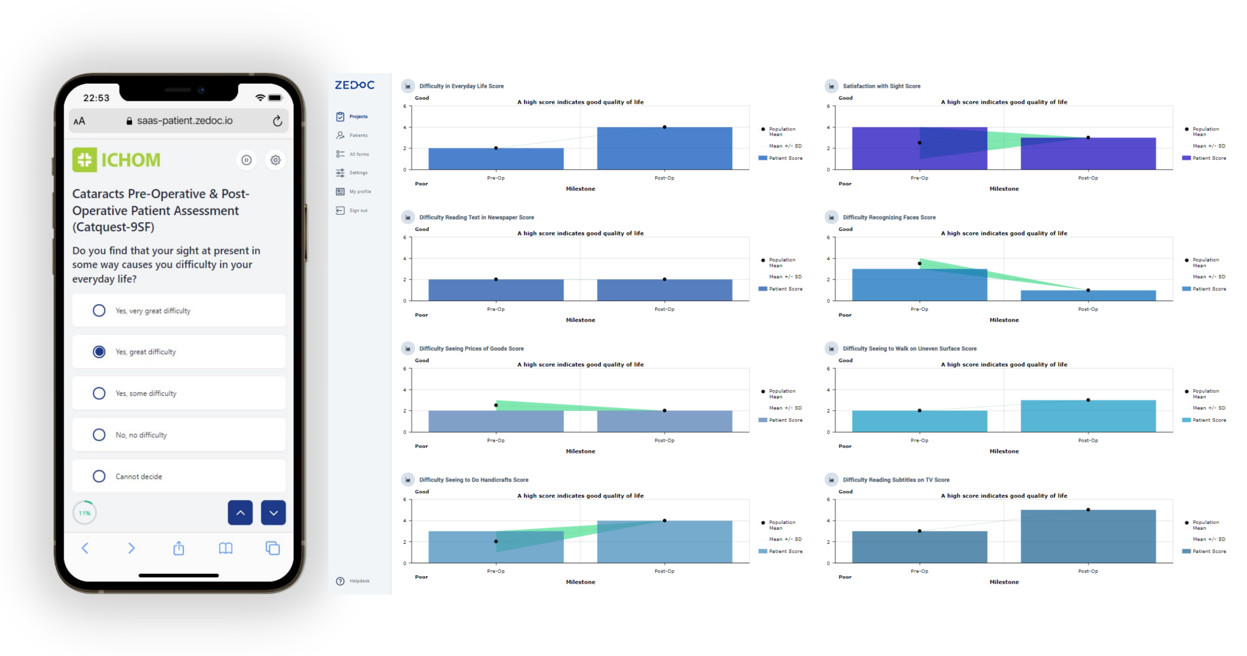 Digital care pathway - Cataracts Surgery — The Clinician
