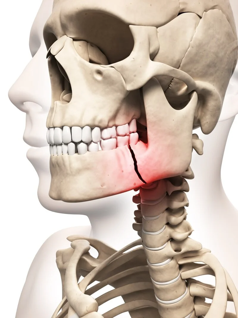 Facial Trauma SD Oral Surgery facial-trauma-sd-oral-surgery