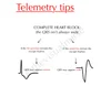 Complete heart block: why is the QRS narrow? — The Visual Nurse