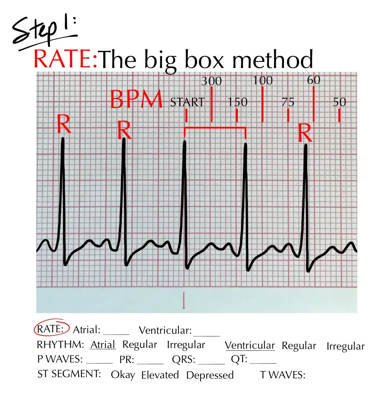 The big box method for HR determination on the ECG (for nurses ...