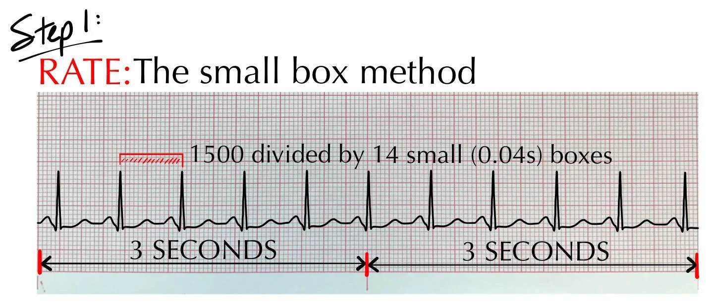 The big box method for HR determination on the ECG (for nurses ...