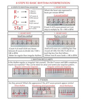 8 simple steps to basic ECG rhythm interpretation for nurses & nursing ...