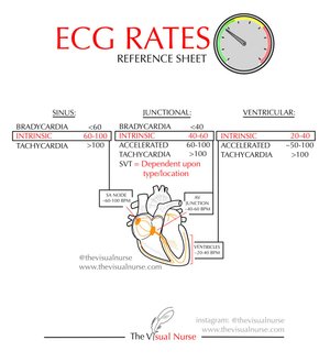 Junctional rhythm recognition on ECG for new nurses and students — The ...