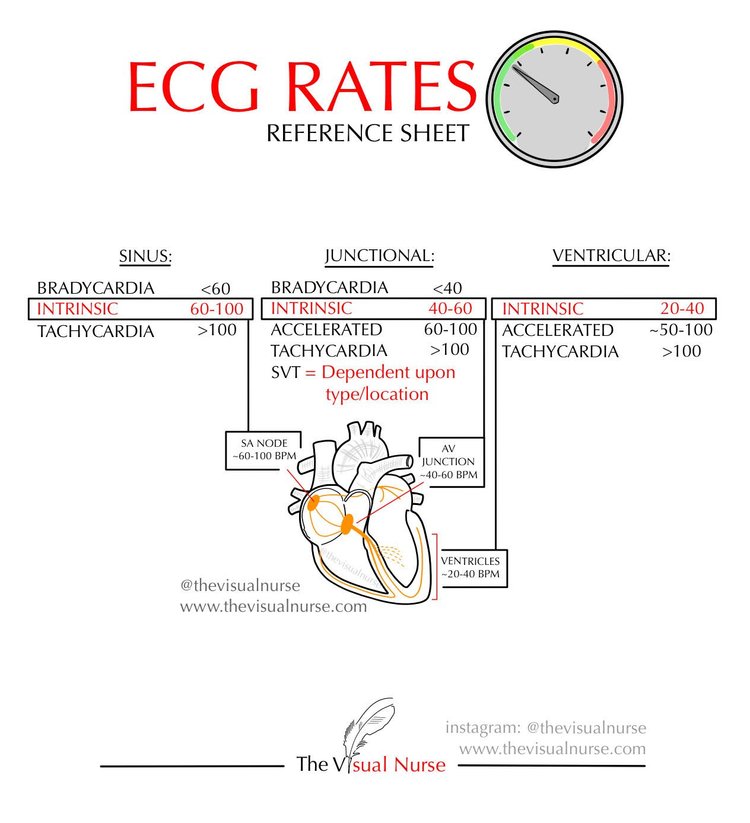 Junctional rhythm recognition on ECG for new nurses and students — The ...