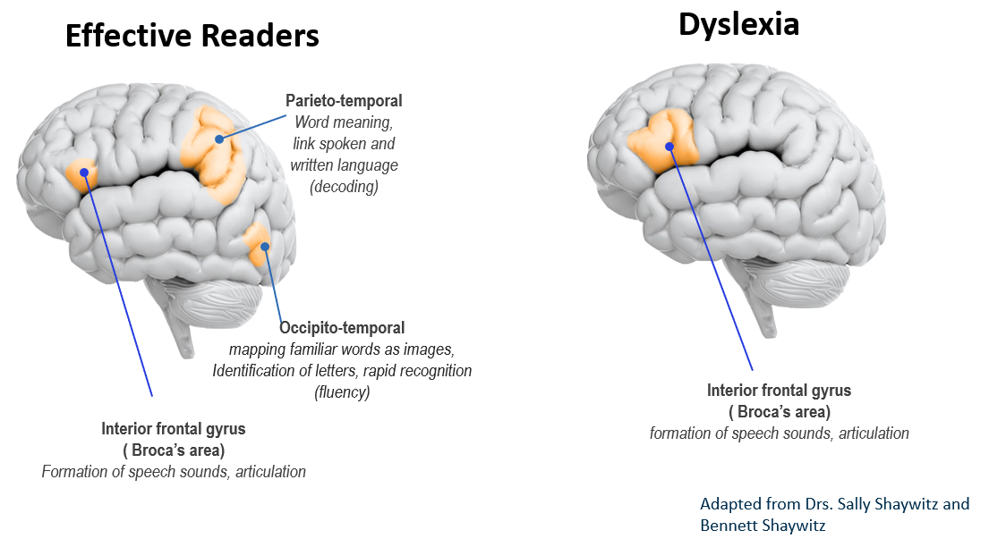 Dyslexia Resources — RISE
