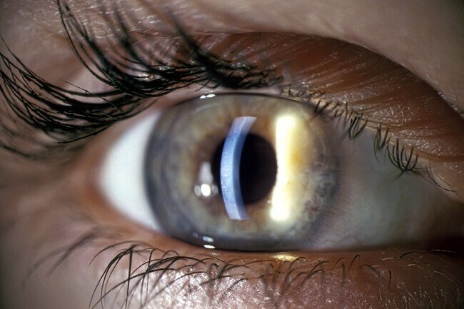 Retina Associates of South Texas, P.A.