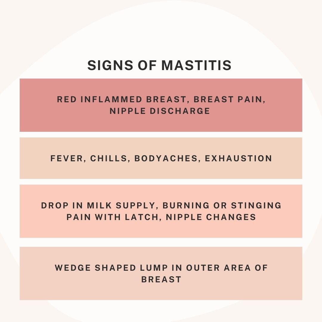 Plugged Milk Duct Vs Mastitis