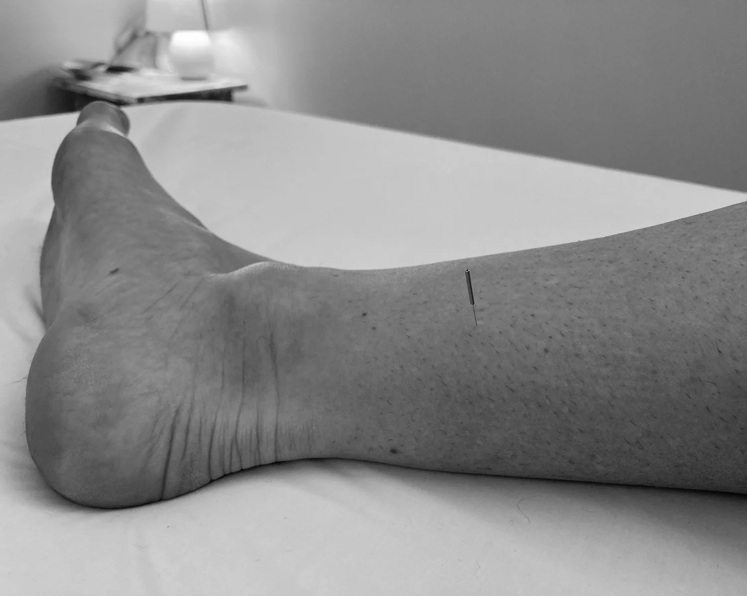 Harmonising the Menstrual Cycle with Acupuncture — Aldebaran Healing