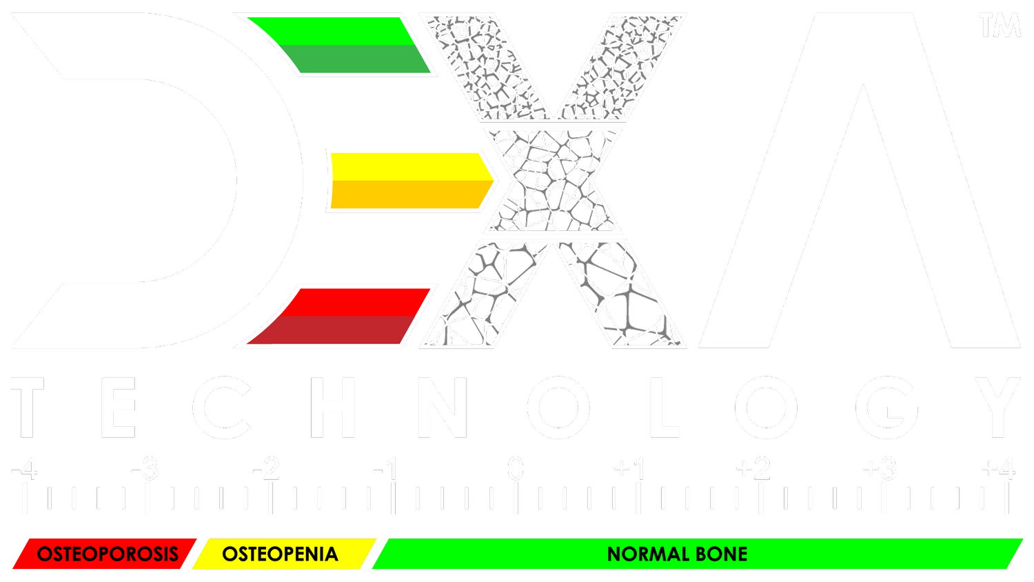 DEXA IMPLANTS - DEXA TECHNOLOGY — DEXA IMPLANTS