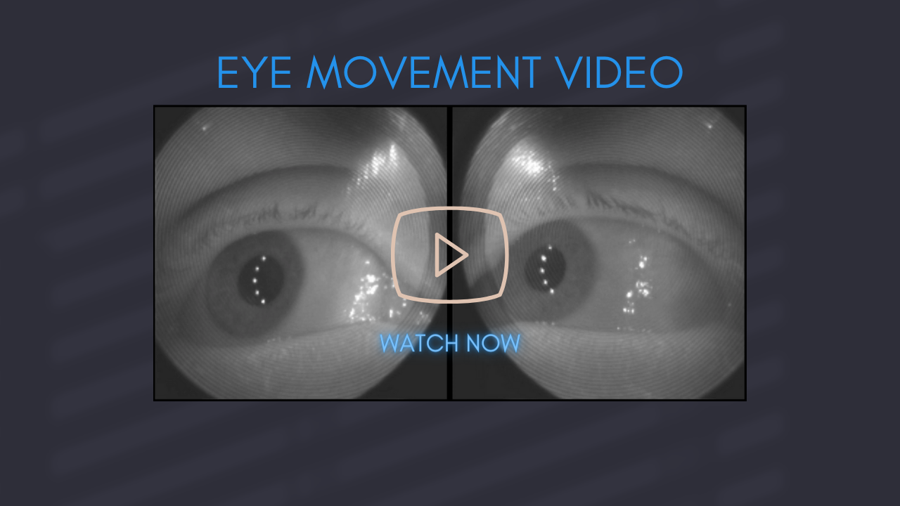 Product - Leading Impairment Detection Technology using Eye Movement ...