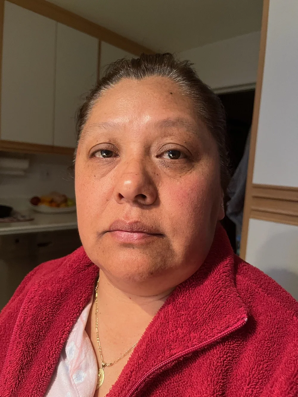 Patient Stories: Rosa 1 — Operation Access