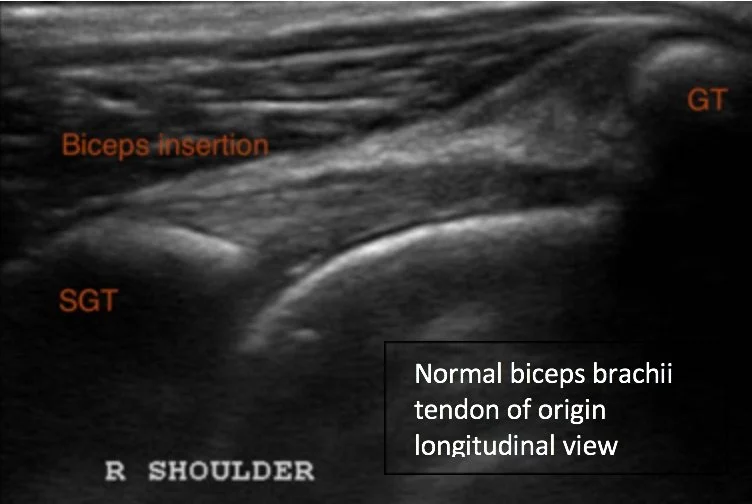 Canine Sports Medicine & Mobility - Musculoskeletal Ultrasound— Canine ...