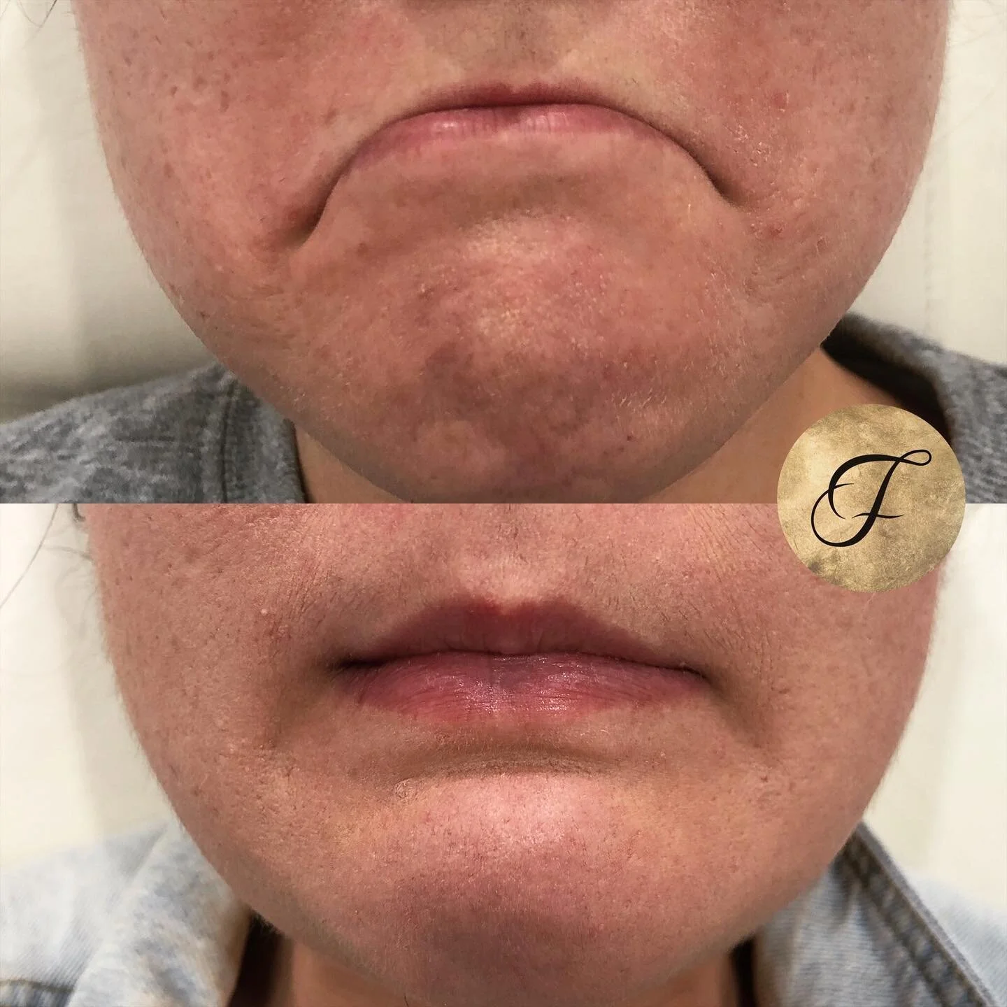 Finesse Face & Beauty