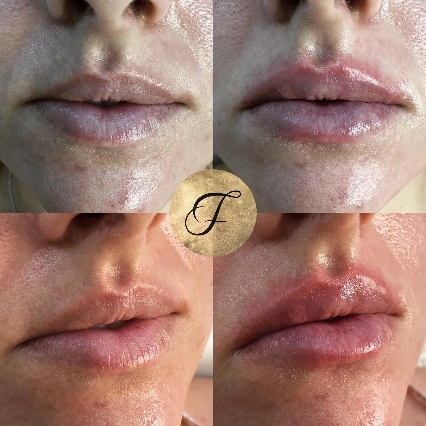 Finesse Face & Beauty