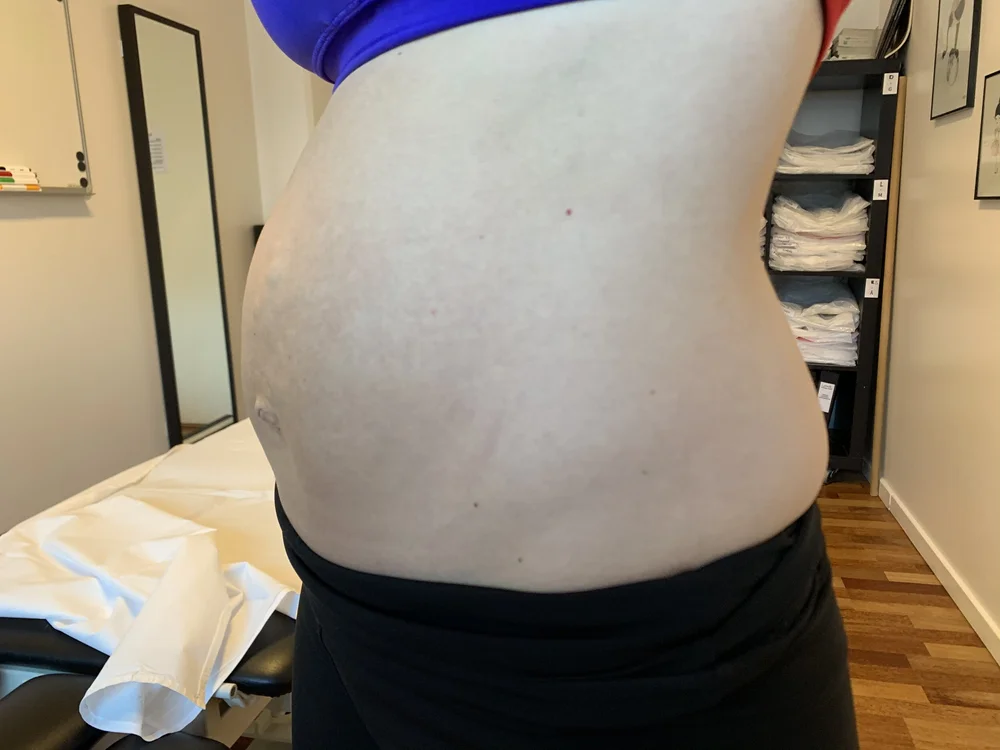 Delte Mavemuskler - Specialiseret fysioterapeutisk vejledning og genoptræning — Klinik for ...