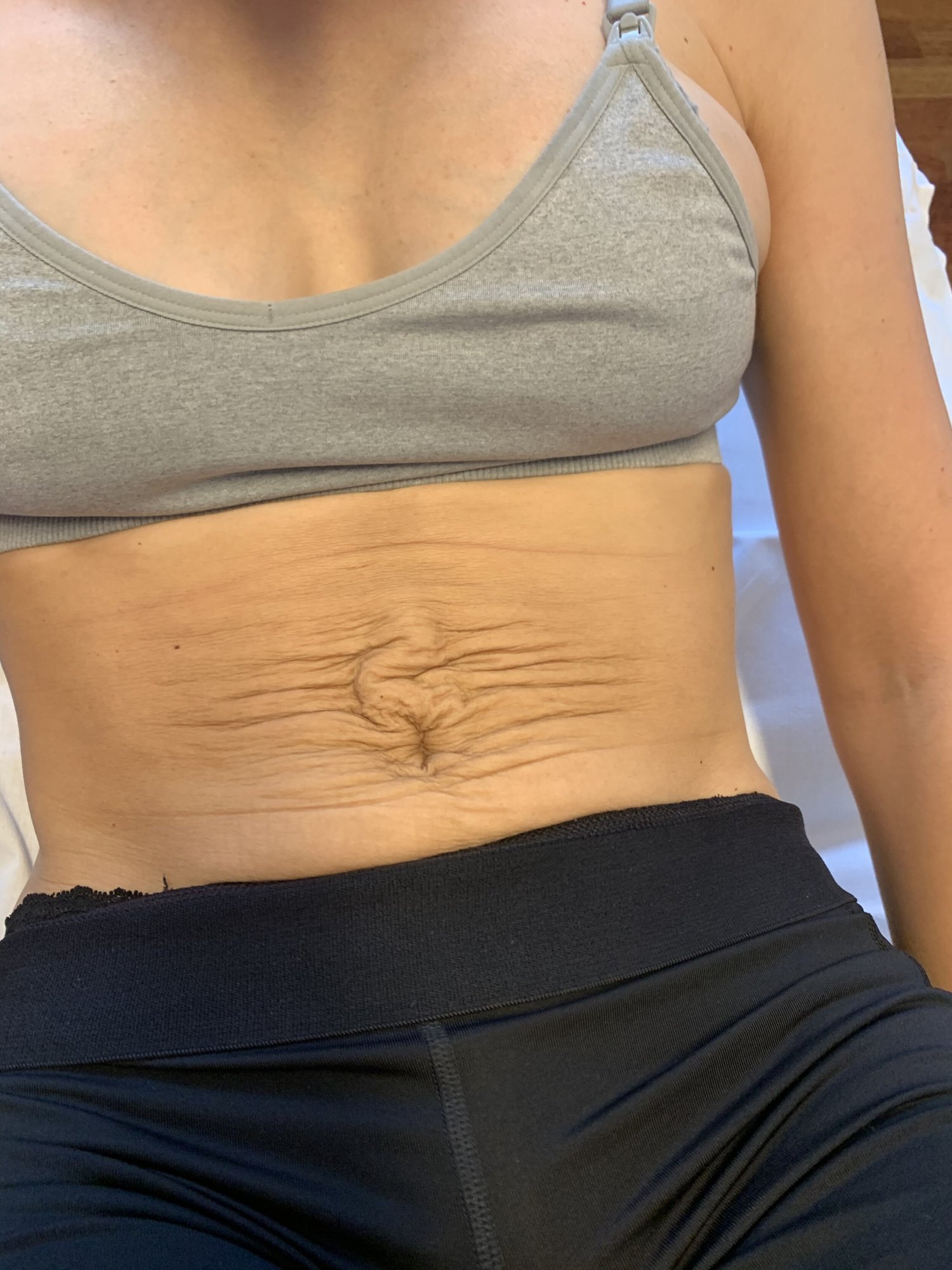 Delte Mavemuskler - Specialiseret fysioterapeutisk vejledning og genoptræning — Klinik for ...