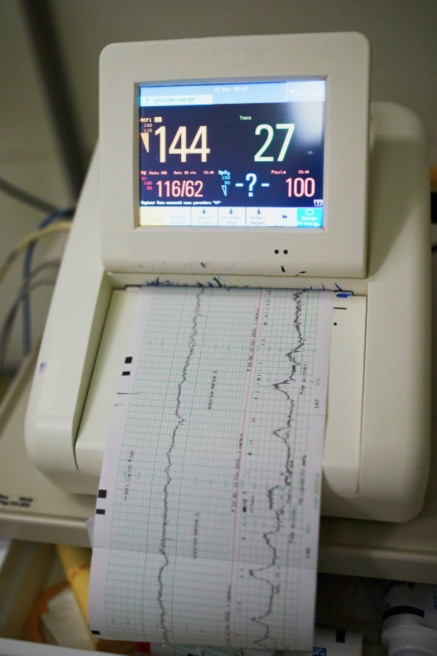 Continuous Electronic Fetal Monitoring during Labour and Birth — Mum's ...
