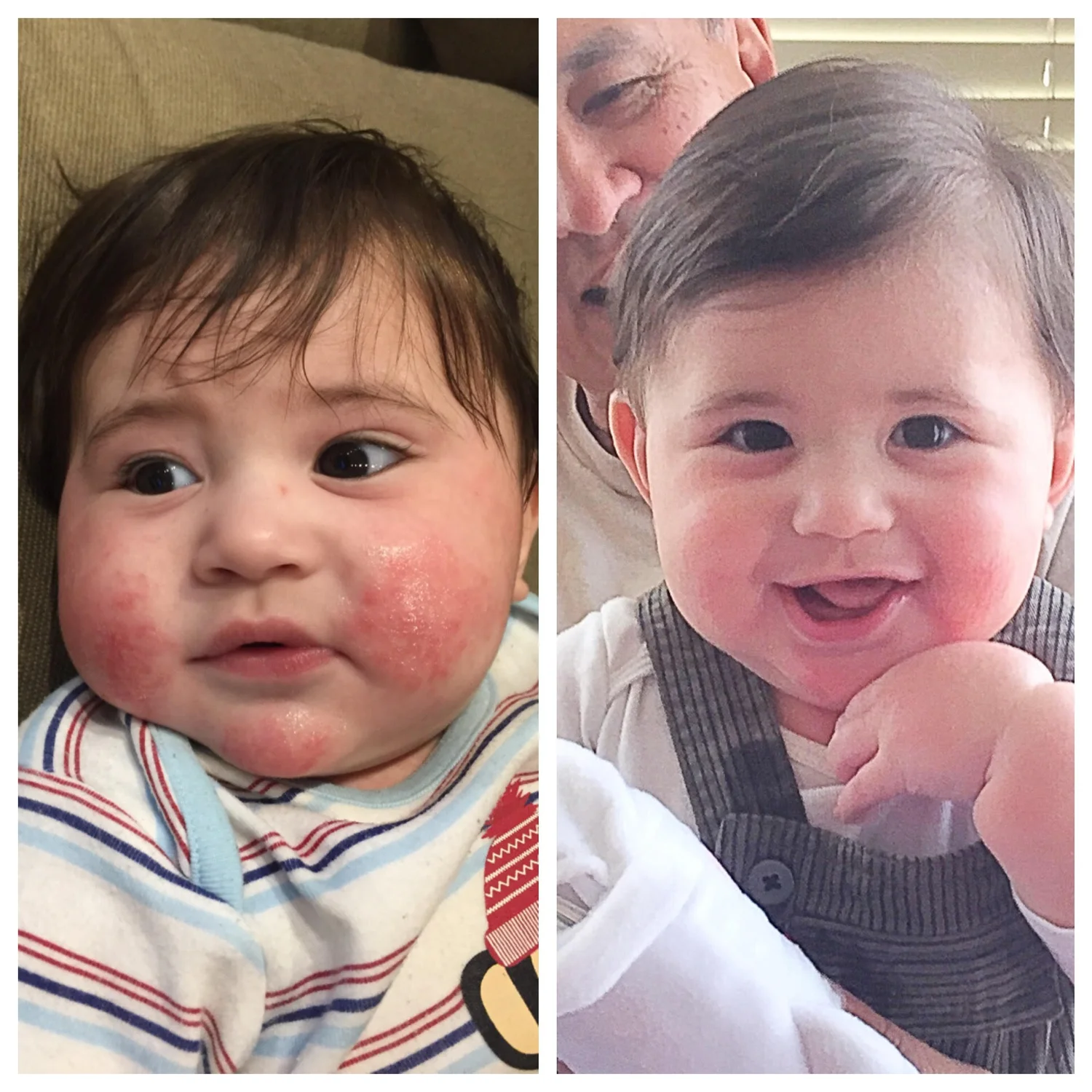 Children's Candida Symptoms — Candida Support