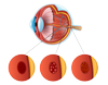 Stages of Age-Related Macular Degeneration | AMD Stages - Visible Genomics
