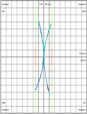 Rhinomanometry — Sleep and Brain