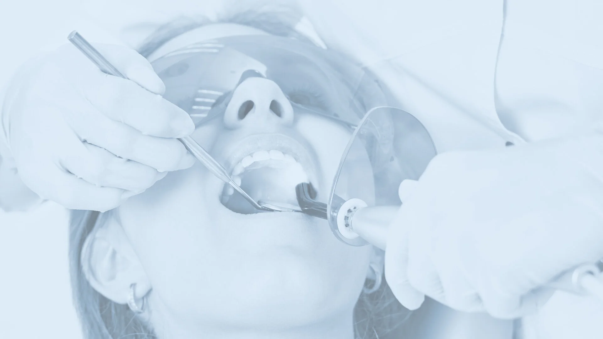 Solutions for Dentists | Get Better Results Using Dental Curing Lights