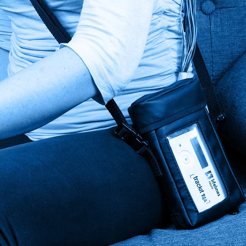 Nervus Ltd Delivers Fast, Accurate Diagnostic Systems For Neurophysiology