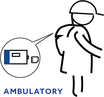 Ambulatory EEG (AEEG)