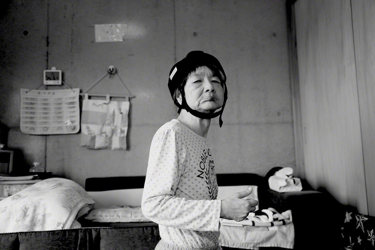 Minamata Disease In Children