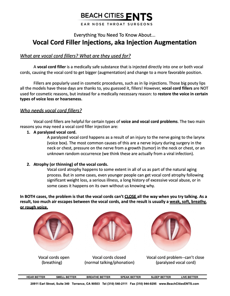 Everything You Need To Know About: Vocal Cord Filler Injections — Beach ...