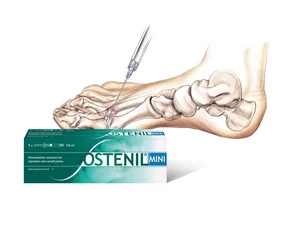 Ostenil Injections — South East Osteopathy