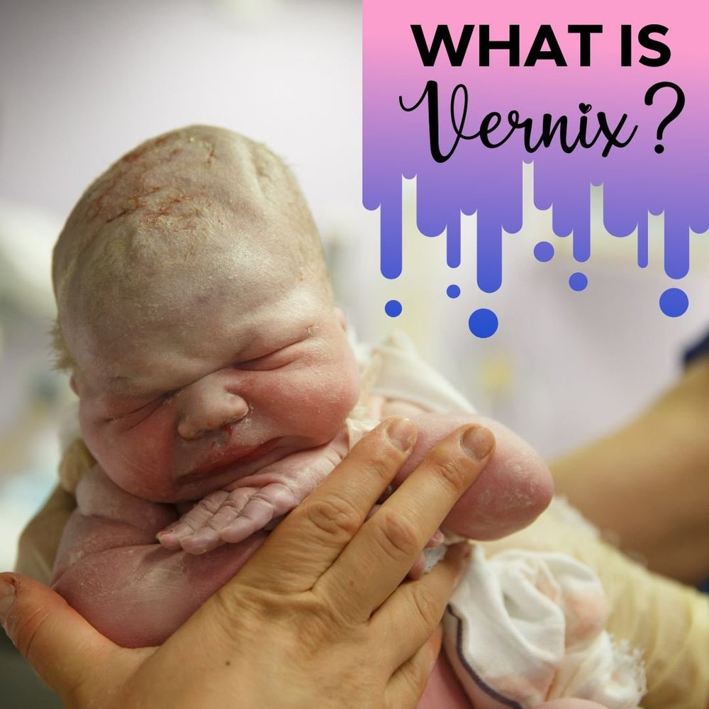 What is Vernix? Benefits for Babies — Fat and Pregnant