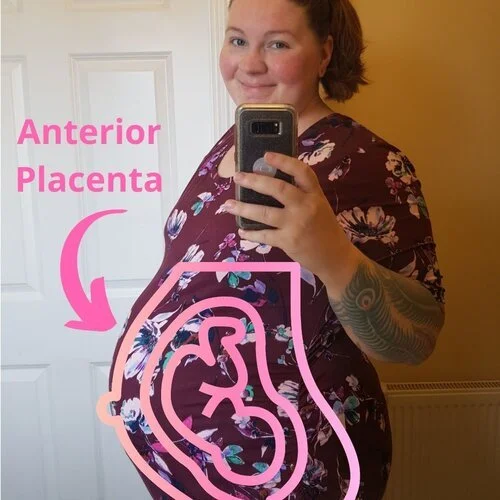 What is An Anterior Placenta? Plus Size Pregnancy — Fat and Pregnant