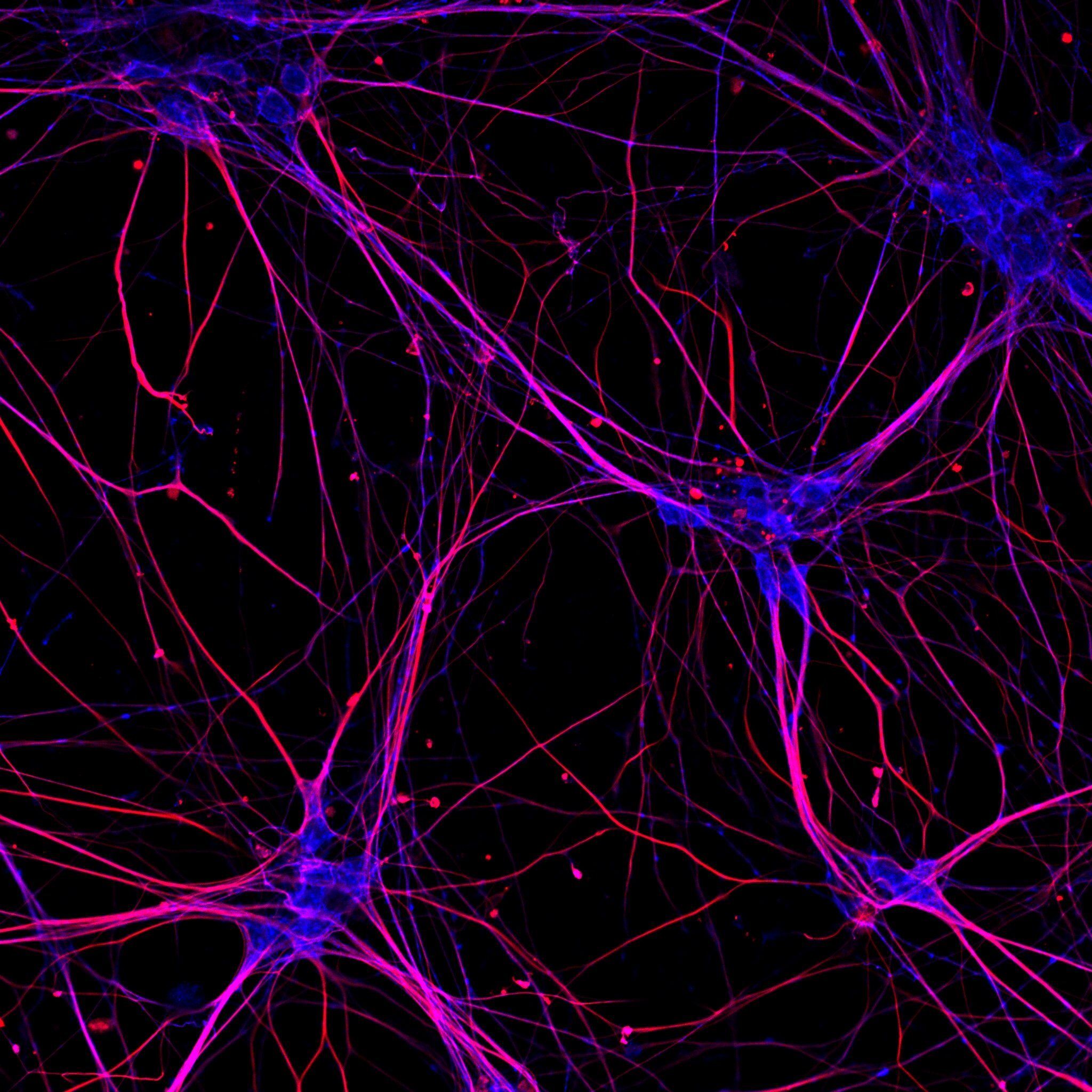 Publications — Kovacs Neuropathology Lab