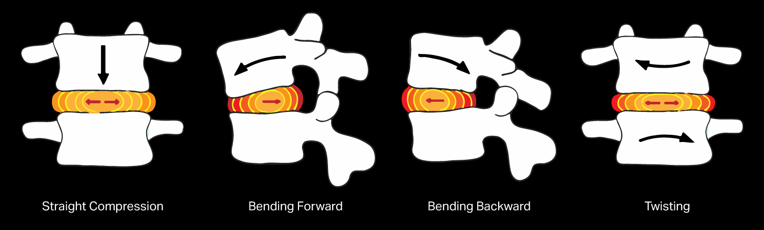 Spine Compression Basics — Laevo Exoskeletons