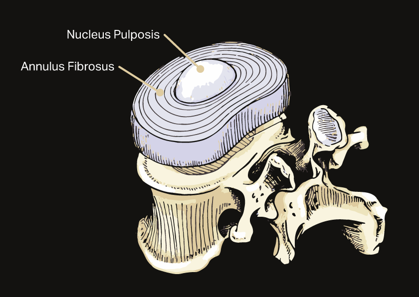Spine Compression Basics — Laevo Exoskeletons