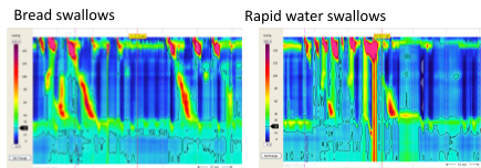 Blog — GI Cognition