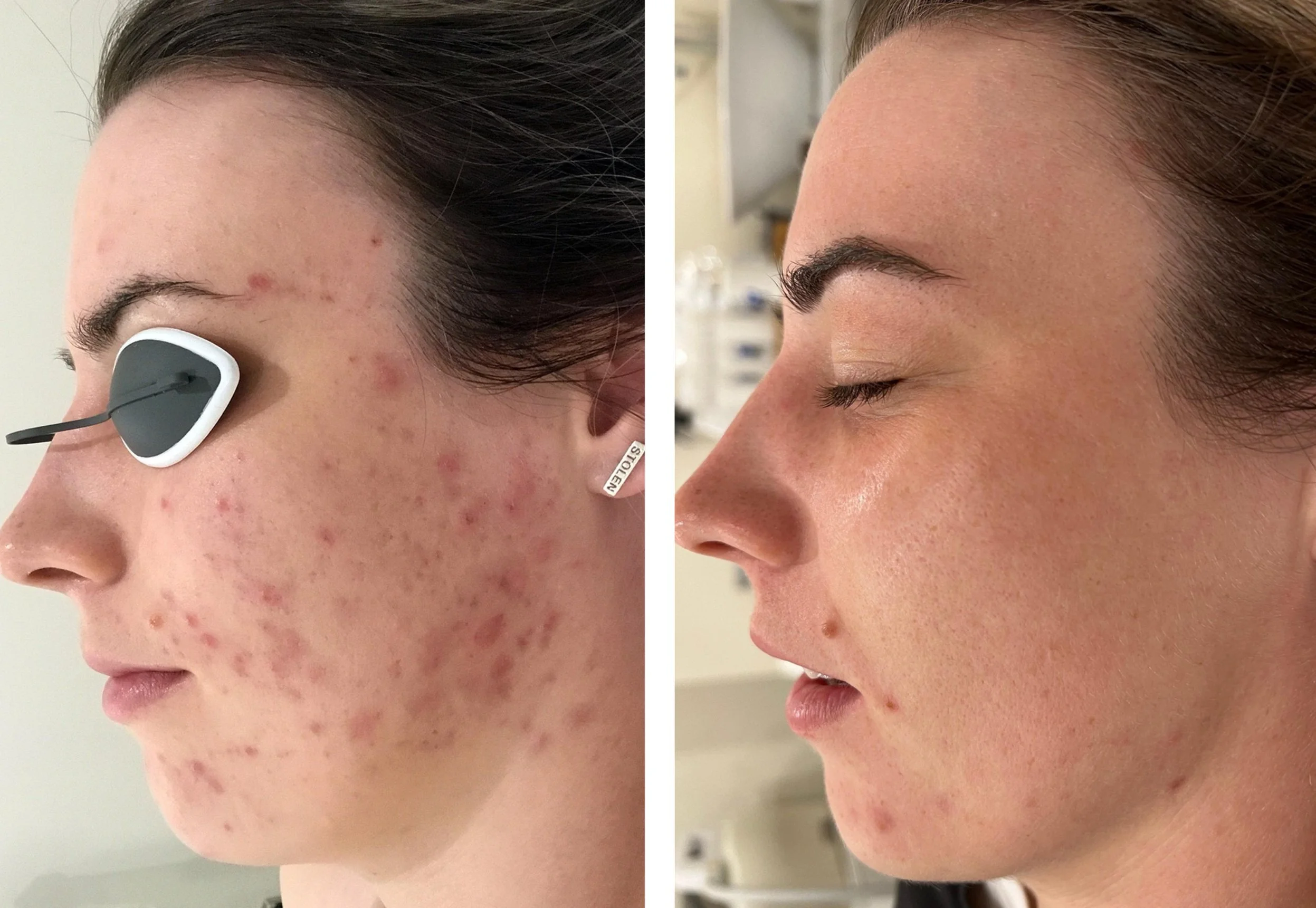 Treatment Specials — Harmony Skin, Beauty & Spa