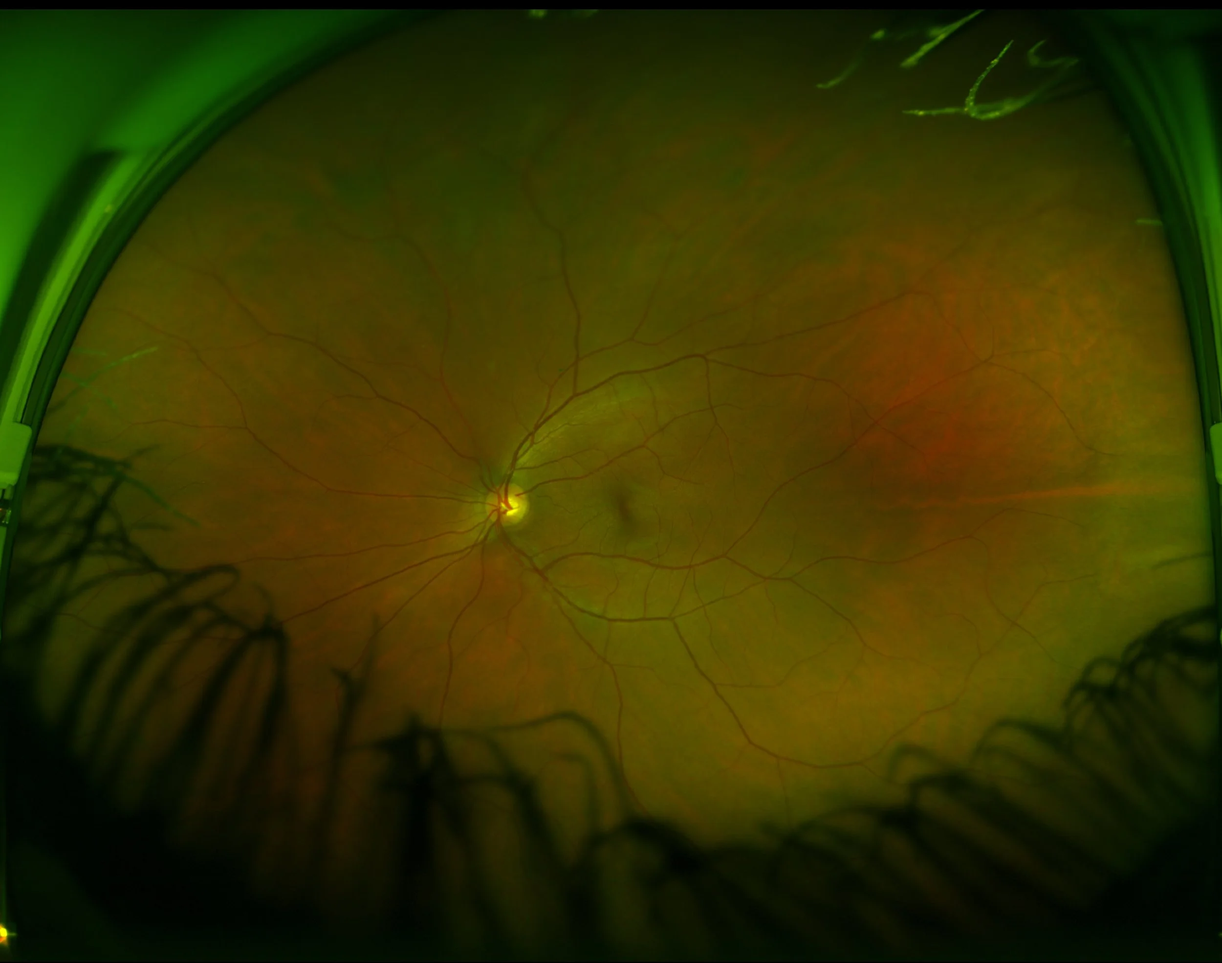 Retinal Imaging — Peak Vision Clinic