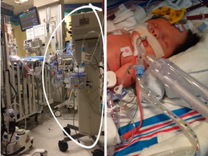 What to Expect - CDH Equipment Explained — Tiny Hero: Real Hope for CDH