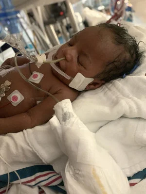 Rakari's CDH Story — Tiny Hero: Real Hope for CDH