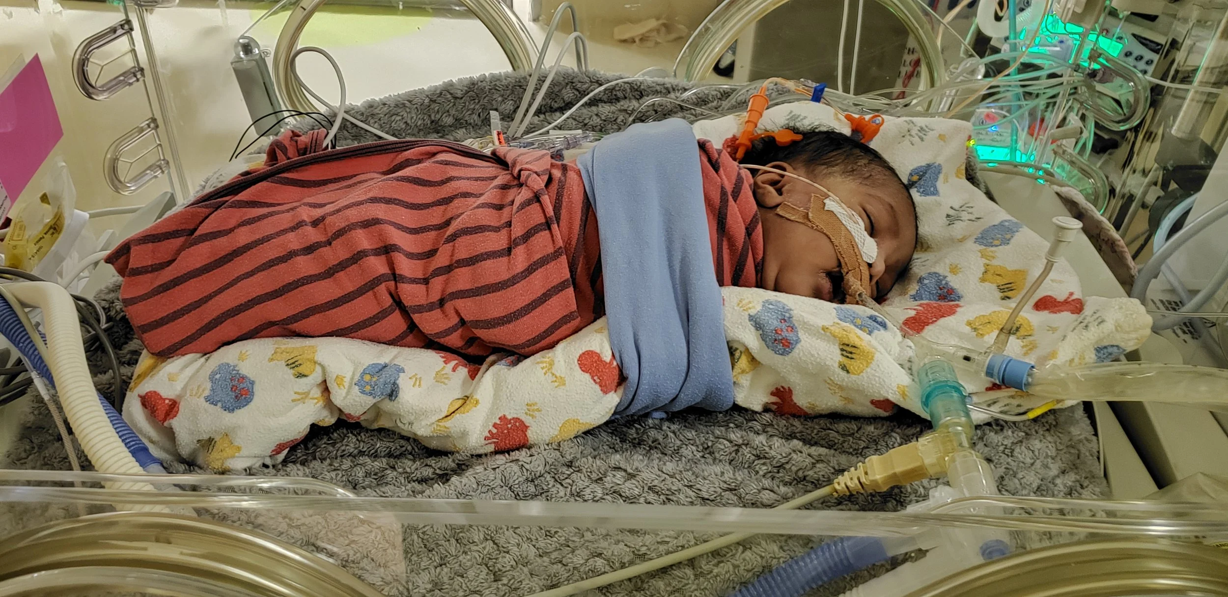 CDH Stories — Tiny Hero: Real Hope for CDH