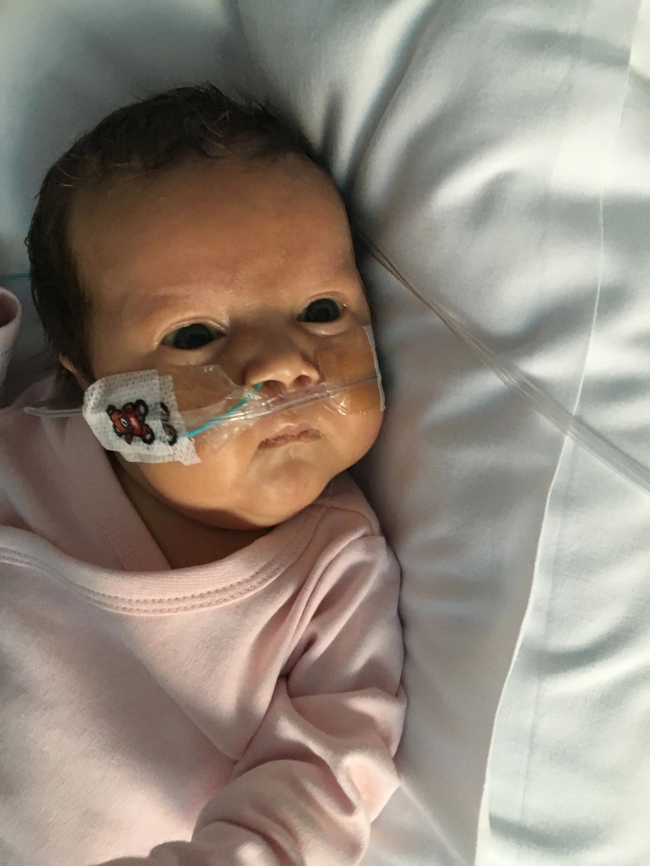 Milly's CDH Story — Tiny Hero: Real Hope for CDH