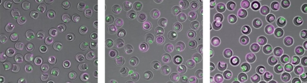 Extracellular Vesicles — Partillion Bioscience - Unlocking Functional ... Extracellular Vesicles — Partillion Bioscience - Unlocking Functional ...