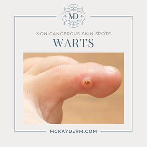 Understanding Non-Cancerous Skin Spots — and When to Consult a ...