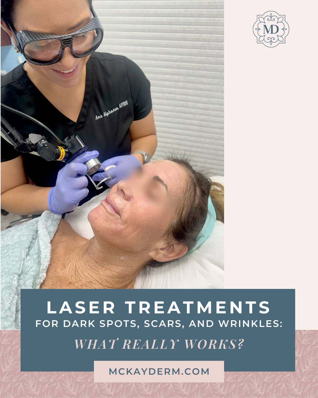 Laser Treatments For Dark Spots Scars And Wrinkles What Really Works