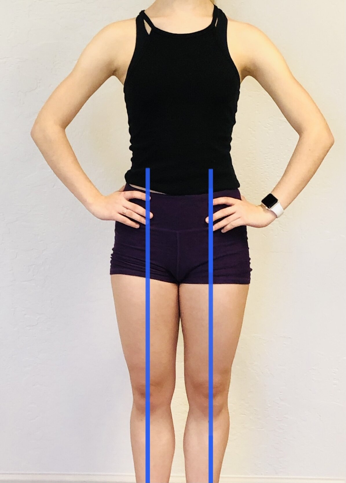 Balanced Dance Medicine for Dancers — Balanced Physical Therapy ...